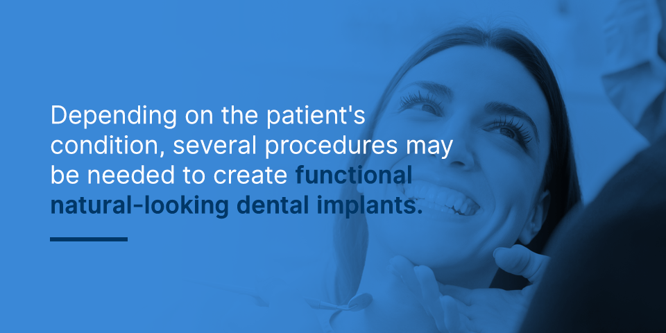 Dental Implant Guide: What You Need To Know | Hiossen® Implant